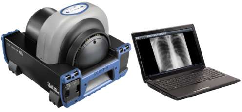 ScanX Fit Digital X-Ray Imaging System W/ Tigerview Laptop - Buy Online ...